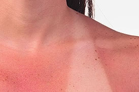 Skin Conditions Archives - Bronx Dermatologist